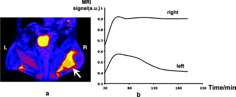 A paramagnetic contrast agent with myeloperoxidase-sensing properties ...