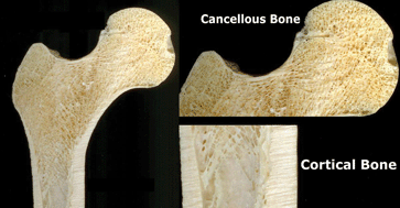 Challenges in forensic toxicology of skeletonised human remains ...