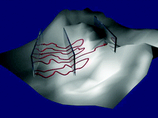 Prospects of transition interface sampling simulations for the ...