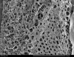 Curable, biodegradable elastomers: emerging biomaterials for drug ...