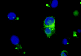 Polymers for intracellular delivery of nucleic acids - Journal of ...