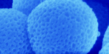 Novel mesoporous silica spheres with ultra-large pore sizes and their ...