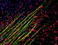 Electrospun nanofibers for neural tissue engineering - Nanoscale (RSC ...