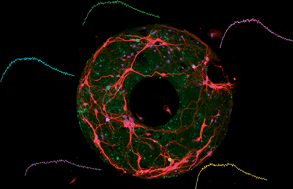 Ring-shaped neuronal networks: a platform to study persistent activity ...