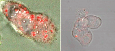 Optimizing photodynamic therapy by liposomal formulation of the ...