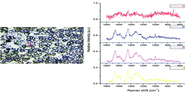 Bio-Raman spectroscopy: a potential clinical analytical method ...