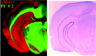 Highlighting anatomical sub-structures in rat brain tissue using lipid ...