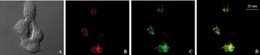 Meta-tetra(hydroxyphenyl)chlorin-loaded liposomes sterically stabilised ...
