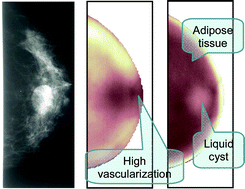 Diffuse optical imaging and spectroscopy of the breast: A brief outline ...