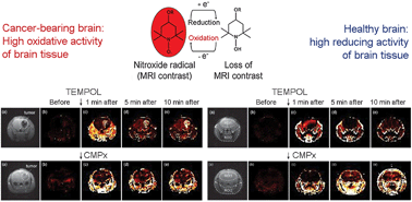 Cell-penetrating nitroxides as molecular sensors for imaging of cancer ...