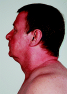 Photodermatoses: environmentally induced conditions with high ...