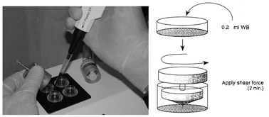 Inner surface modification of the tube-like elements for medical ...