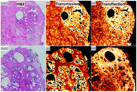 Comparison of transmission and transflectance mode FTIR imaging of ...
