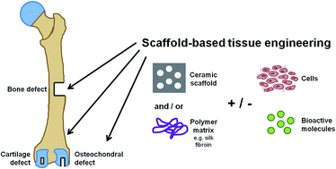 Scaffold-based regeneration of skeletal tissues to meet clinical challenges - Journal of ...