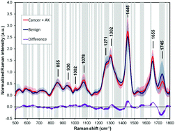 Wavenumber selection based analysis in Raman spectroscopy improves skin ...
