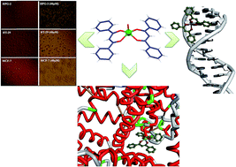 A mononuclear diketone-based oxido-vanadium(iv) complex: structure, DNA ...