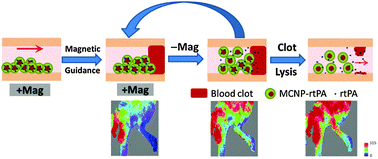 Magnetically controlled release of recombinant tissue plasminogen ...