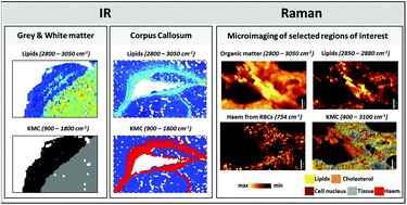 IR and Raman imaging of murine brains from control and ApoE/LDLR−/− ...