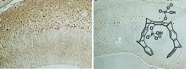 Molecular tweezers for lysine and arginine – powerful inhibitors of ...
