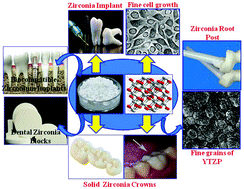 Zirconia based dental ceramics: structure, mechanical properties ...