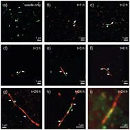 Super-resolution imaging of alpha-synuclein polymorphisms and their ...