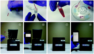 A field-deployable mobile molecular diagnostic system for malaria at ...