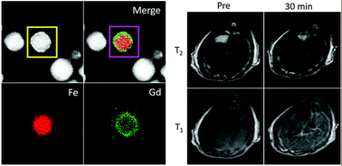 Core/shell Fe3O4/Gd2O3 nanocubes as T1–T2 dual modal MRI contrast ...