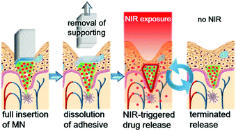 Implantable polymeric microneedles with phototriggerable properties as ...