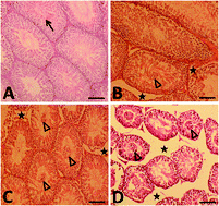 Lead aggravates the diabetic-induced reproductive toxicity in male ...