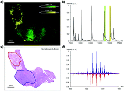 Mass spectrometry imaging for clinical research – latest developments ...