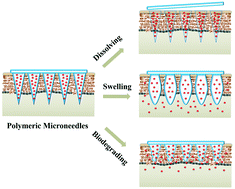 Recent advances in the design of polymeric microneedles for transdermal ...