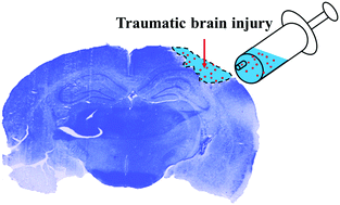 Potential application of an injectable hydrogel scaffold loaded with ...