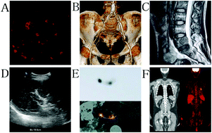 Applications of nanoparticles in biomedical imaging - Nanoscale (RSC ...
