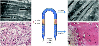 Silk fibroin and hydroxyapatite segmented coating enhances graft ...