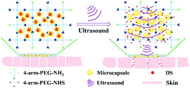 Microcapsule-embedded hydrogel patches for ultrasound responsive and ...