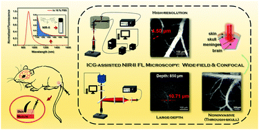 Deciphering of cerebrovasculatures via ICG-assisted NIR-II fluorescence ...