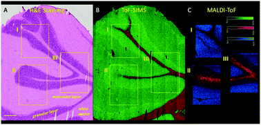 Multimodal chemical imaging of a single brain tissue section using ToF ...