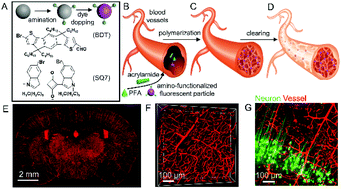 LIMPID: a versatile method for visualization of brain vascular networks ...
