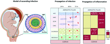 Modeling ascending infection with a feto-maternal interface organ-on ...