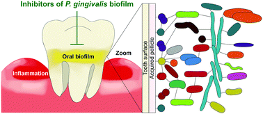 Porphyromonas gingivalis: where do we stand in our battle against this ...