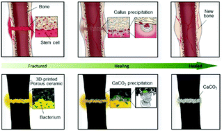 Bone-inspired healing of 3D-printed porous ceramics - Materials ...