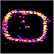 Nanoscale surface structures of DNA bound to Deinococcus radiodurans HU ...