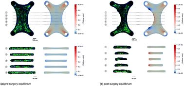 A model for 3D deformation and reconstruction of contractile ...