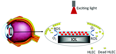 Surface modification of intraocular lenses via photodynamic coating for ...