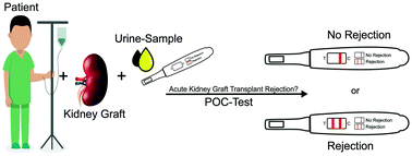 A new lateral flow assay to detect sIL-2R during T-cell mediated ...
