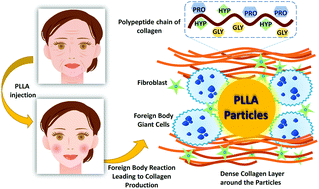 Collagen and the effect of poly-l-lactic acid based materials on its ...