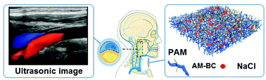 Retracted Article: A solid ultrasonic coupling membrane for superficial ...