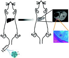 A gadofullerene based liver-specific MRI contrast agent for an early ...