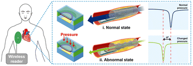 Stress induced self-rollable smart-stent-based U-health platform for in ...