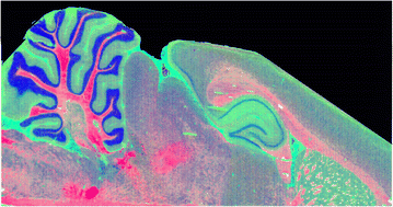 Association between ageing, brain chemistry and white matter volume ...